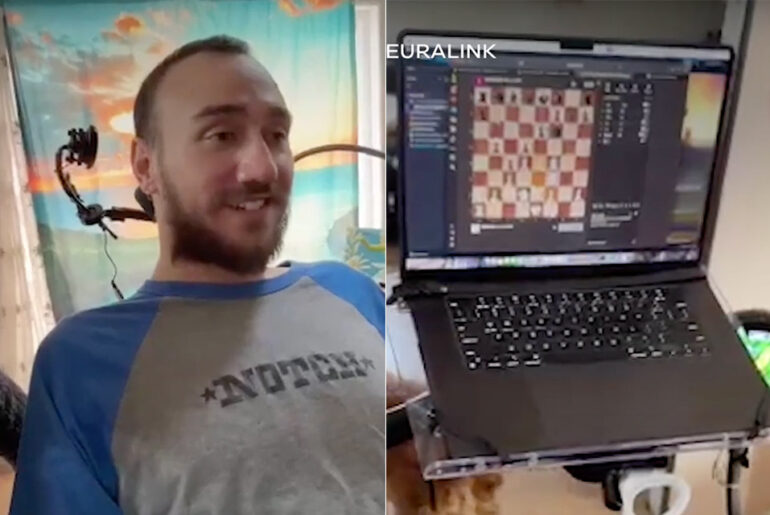 Neuralink Patient with Brain Implant Successfully Plays PC Games Using ...