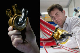 Australian Man Leaves Hospital with Full Titanium Artificial Heart from ...