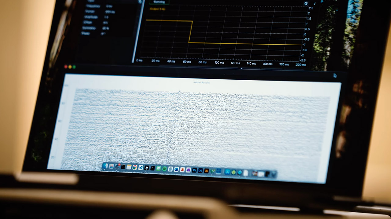 Neuralink Rival Paradromics Successfully Implants Connexus Brain ...